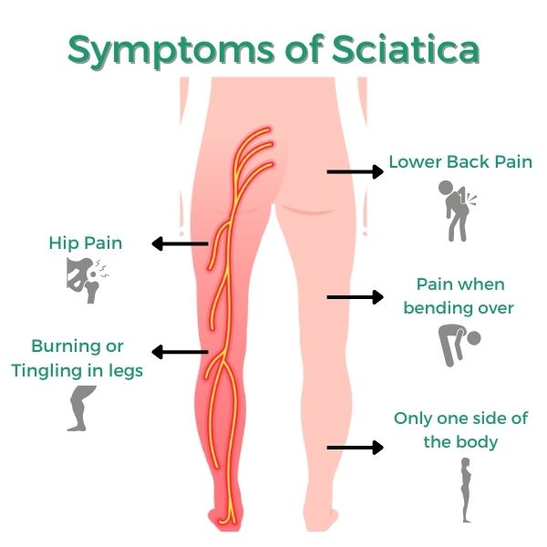 2 Major Distinctions Between Sciatica and Spinal Stenosis